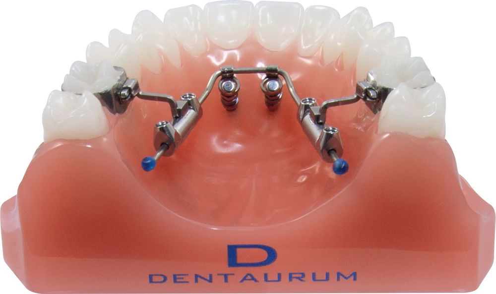 KFO-Demonstrationsmodell tomas®/amda® - DENTAURUM Online Shop